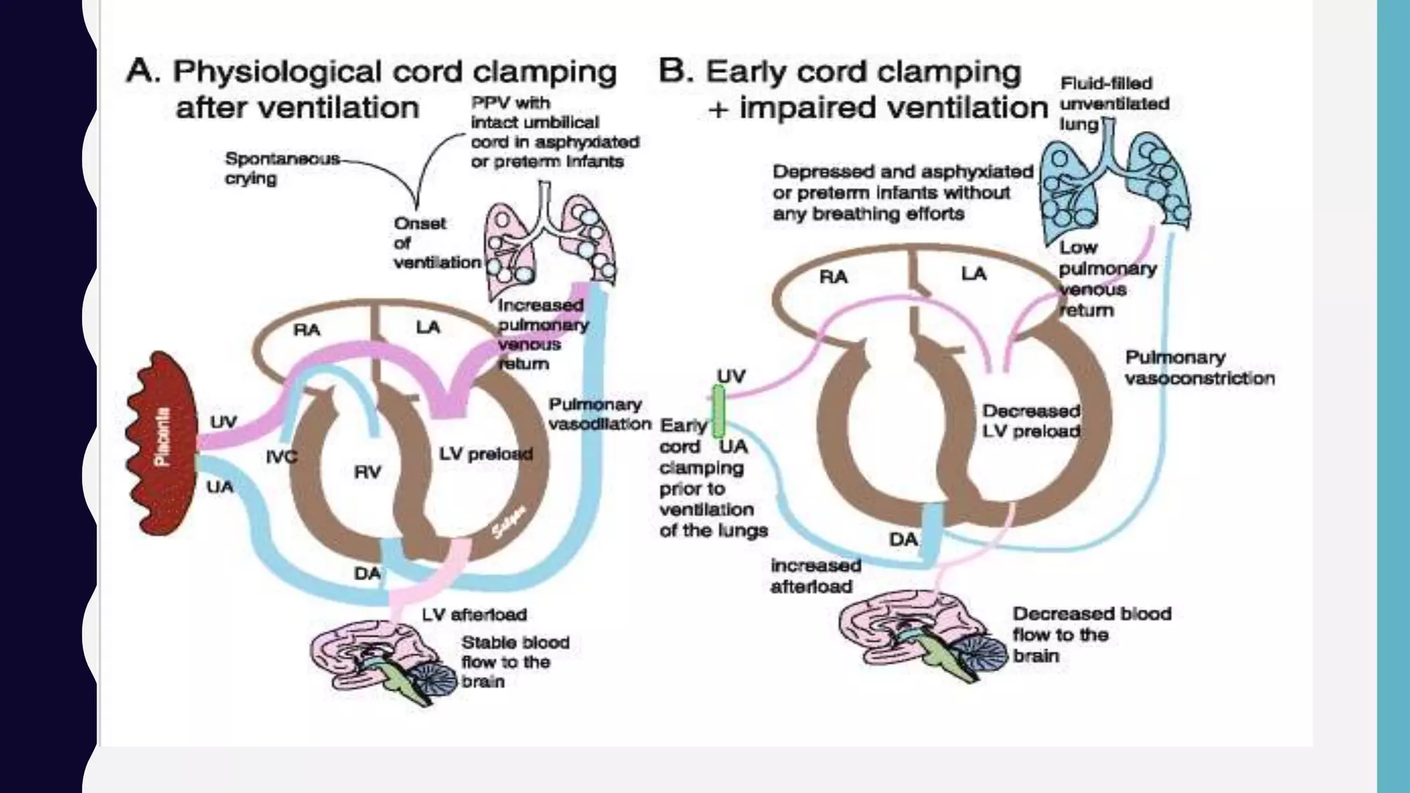 physiology of transition circulation | PPTX
