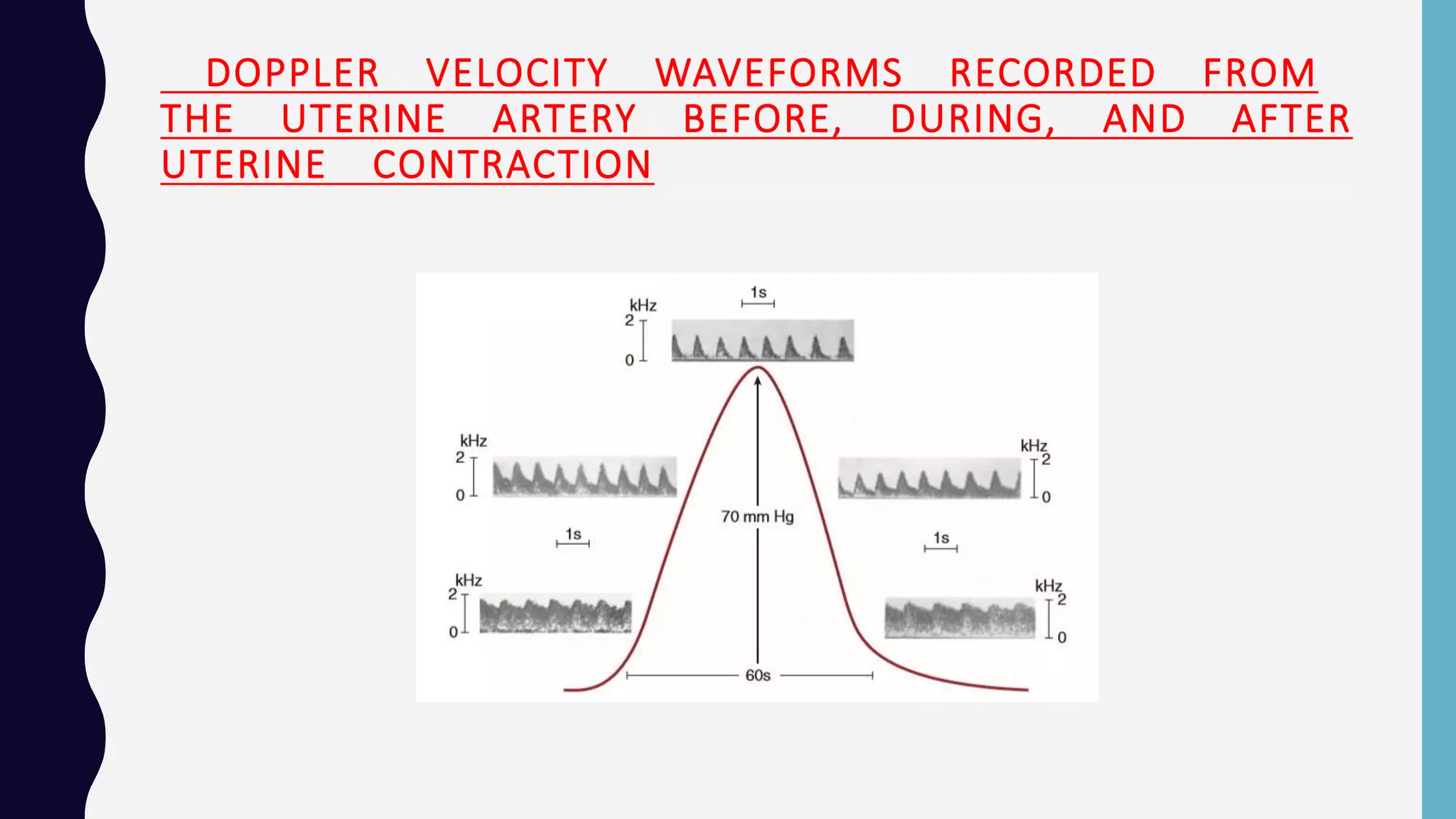 physiology of transition circulation | PPTX