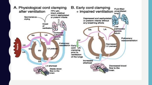 physiology of transition circulation | PPTX | Pregnancy | Reproductive ...