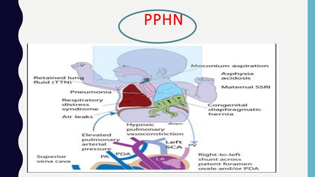 physiology of transition circulation