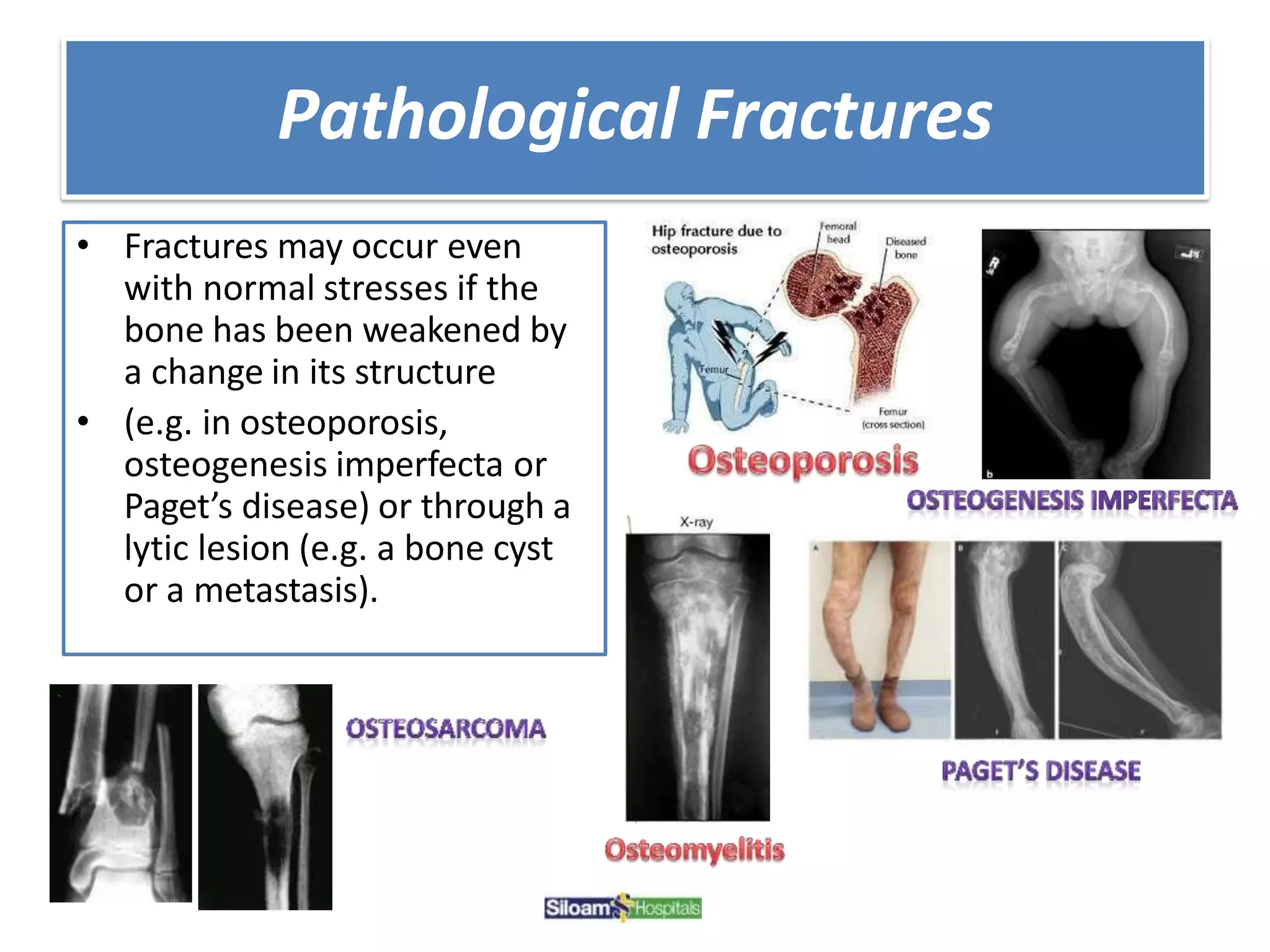 PPT trauma muskuloskeletal dr. Satria, Sp.OT.pptx