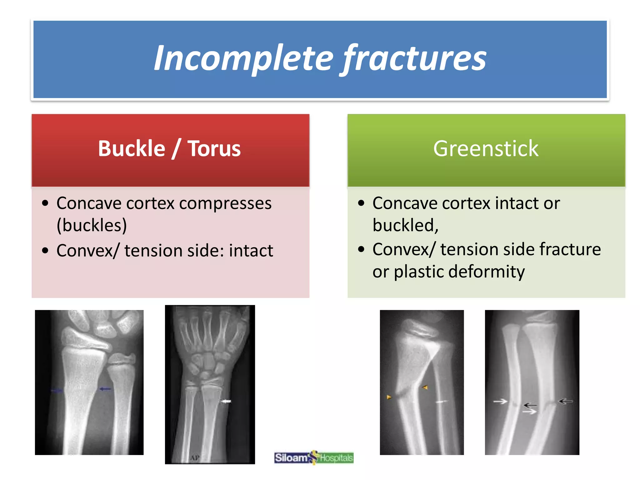 PPT trauma muskuloskeletal dr. Satria, Sp.OT.pptx