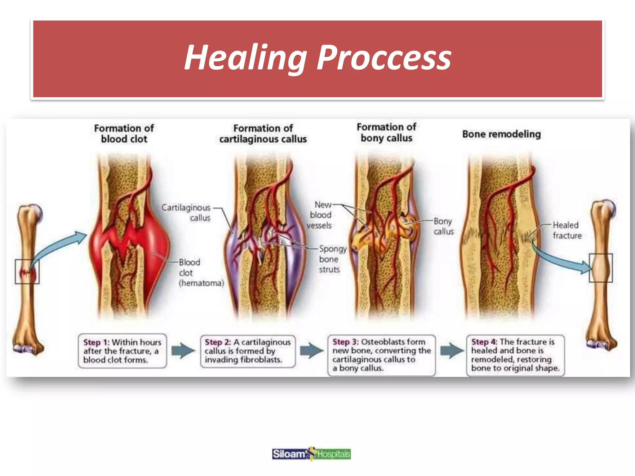 PPT trauma muskuloskeletal dr. Satria, Sp.OT.pptx