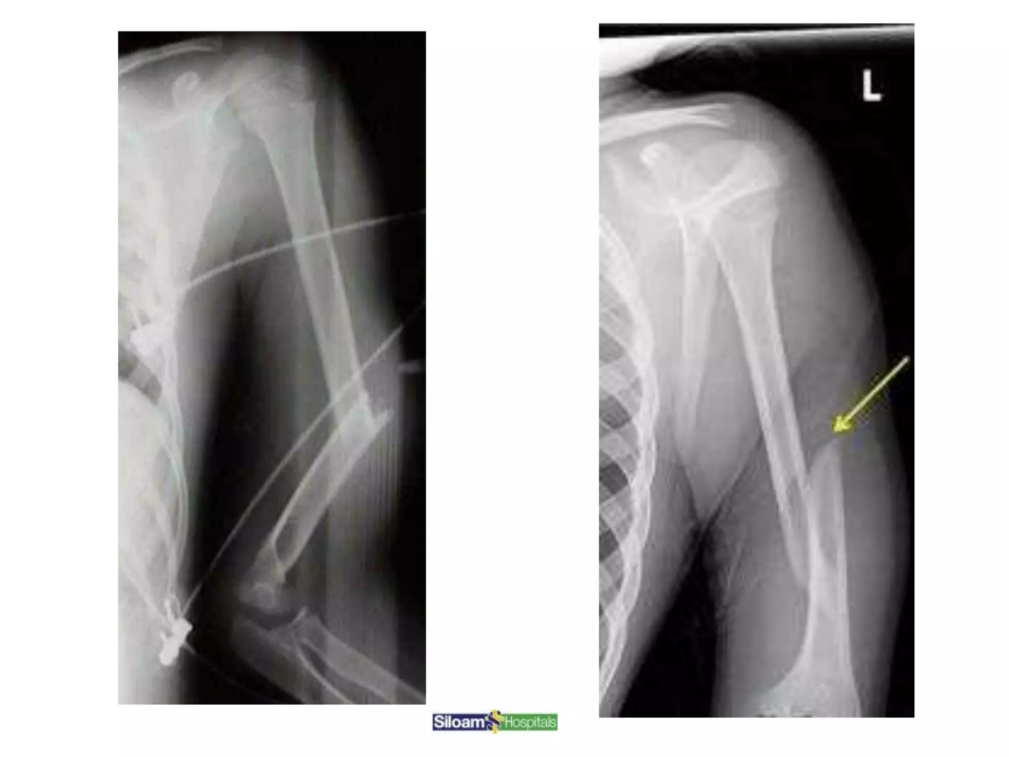 PPT trauma muskuloskeletal dr. Satria, Sp.OT.pptx