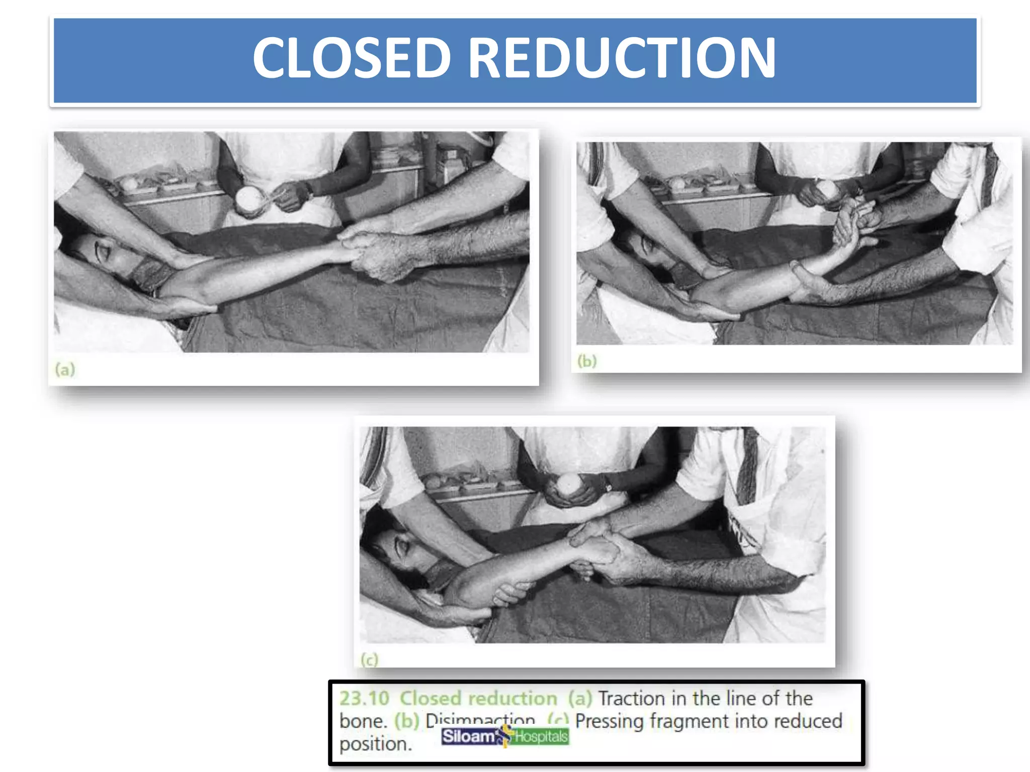 PPT trauma muskuloskeletal dr. Satria, Sp.OT.pptx