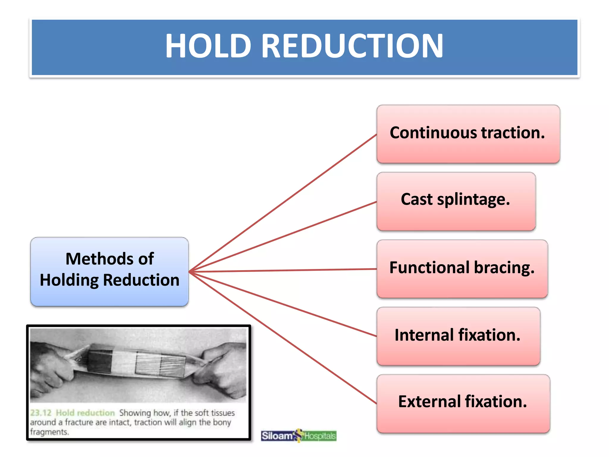 PPT trauma muskuloskeletal dr. Satria, Sp.OT.pptx