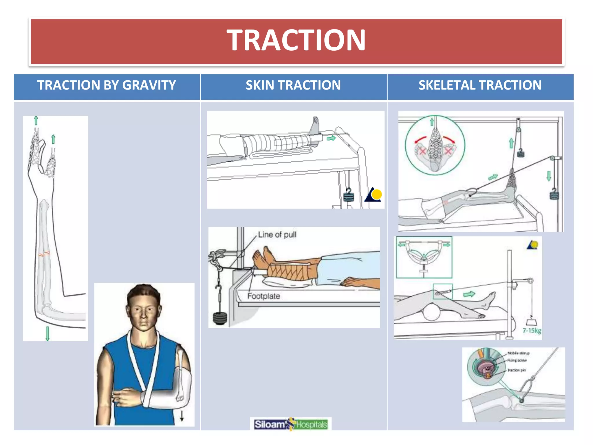 PPT trauma muskuloskeletal dr. Satria, Sp.OT.pptx