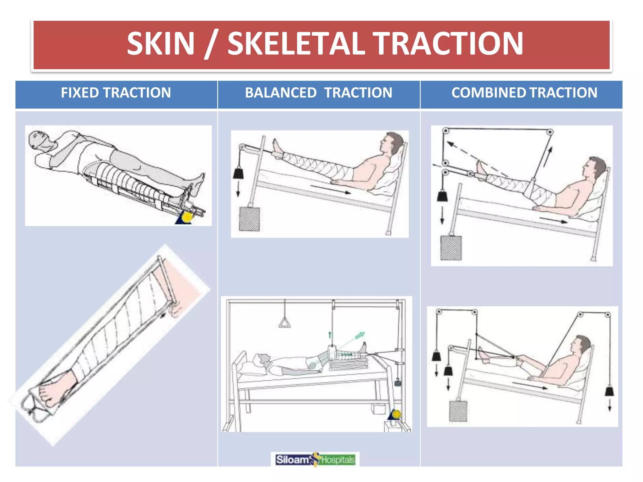 PPT trauma muskuloskeletal dr. Satria, Sp.OT.pptx