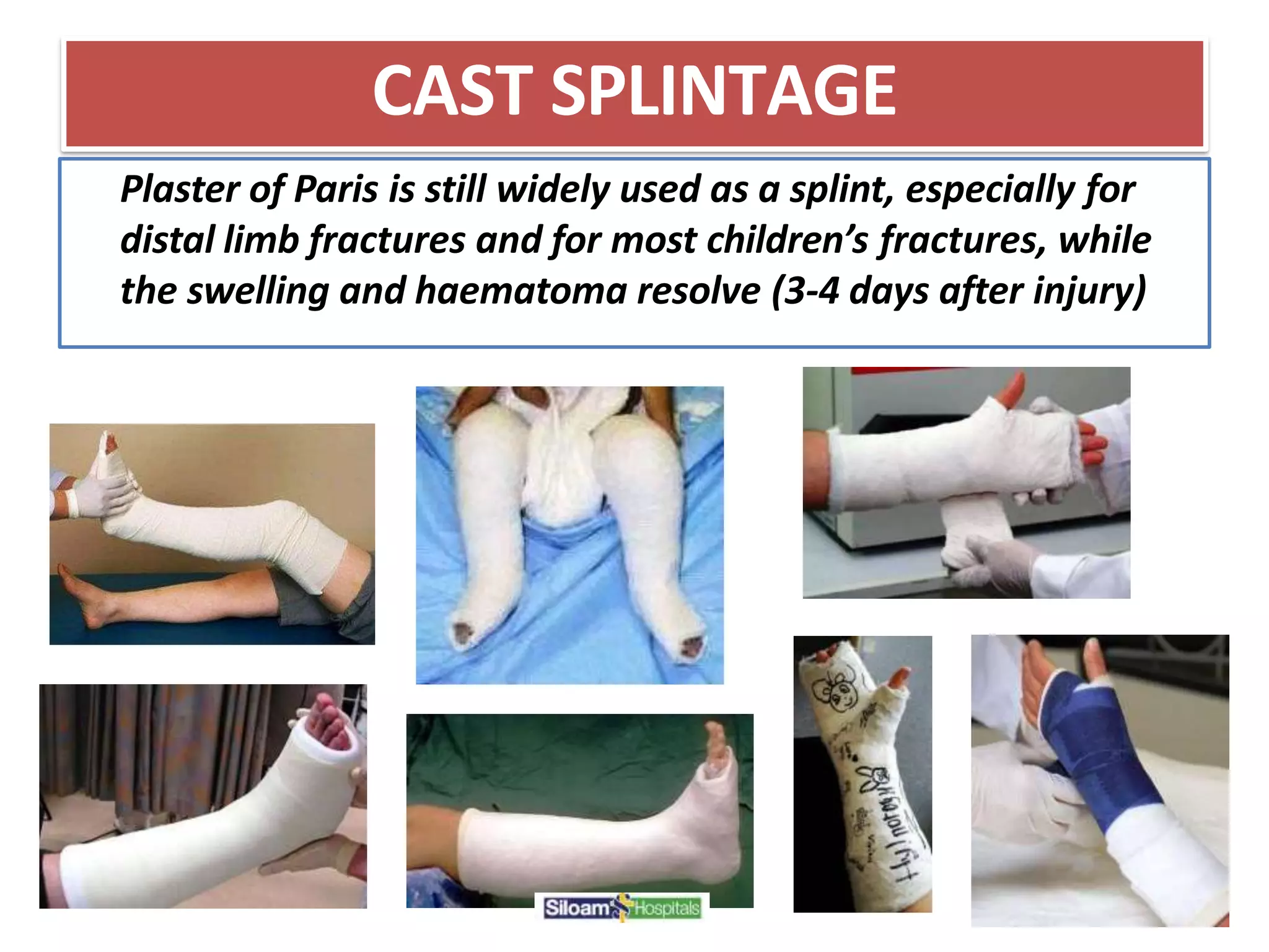PPT trauma muskuloskeletal dr. Satria, Sp.OT.pptx