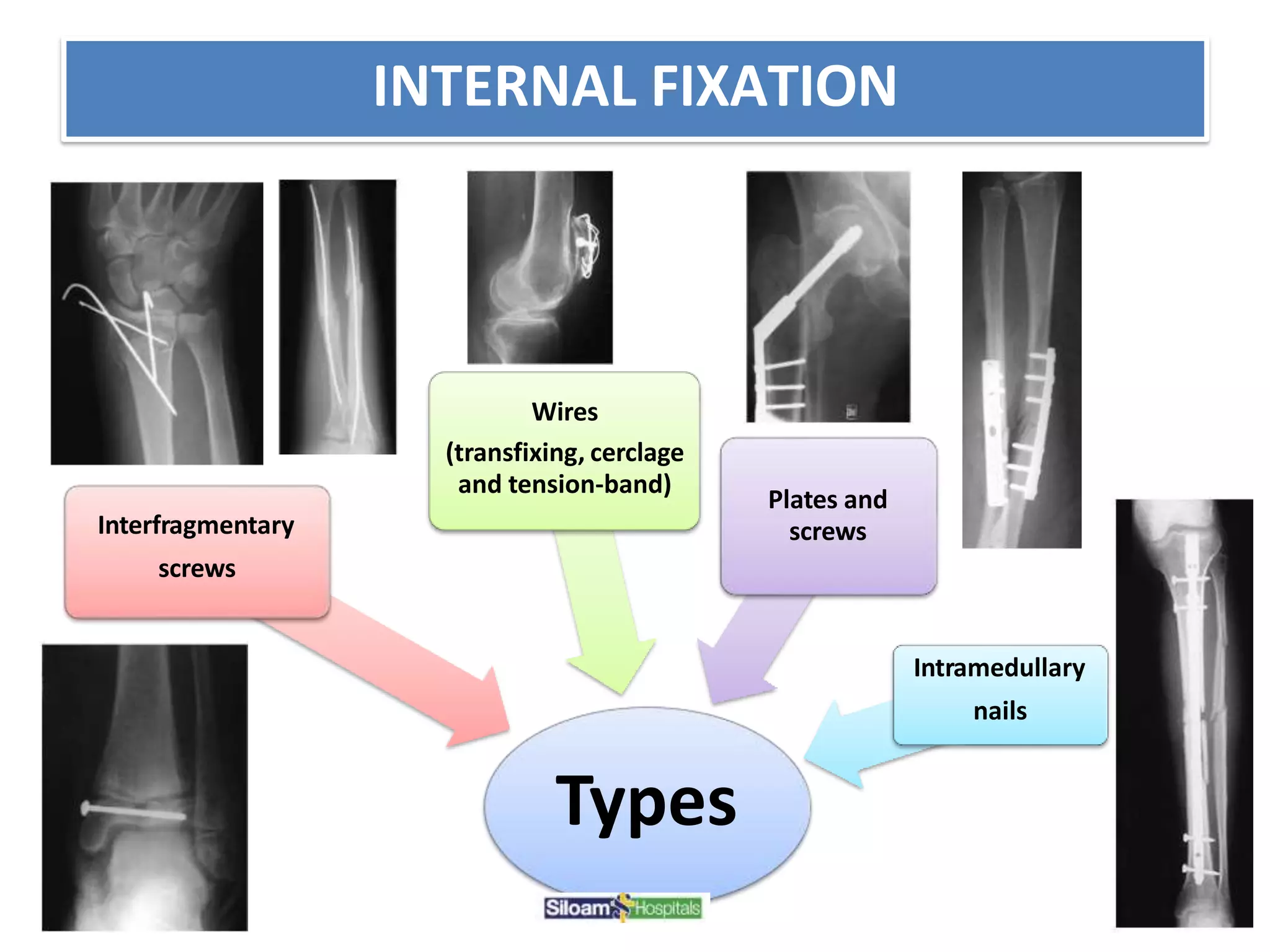 PPT trauma muskuloskeletal dr. Satria, Sp.OT.pptx