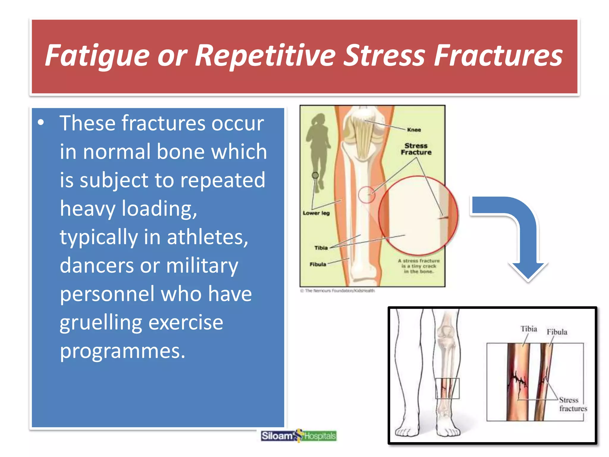 PPT trauma muskuloskeletal dr. Satria, Sp.OT.pptx