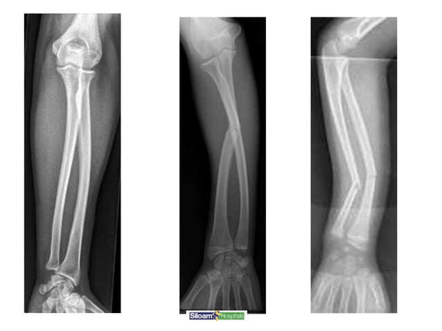 PPT trauma muskuloskeletal dr. Satria, Sp.OT.pptx