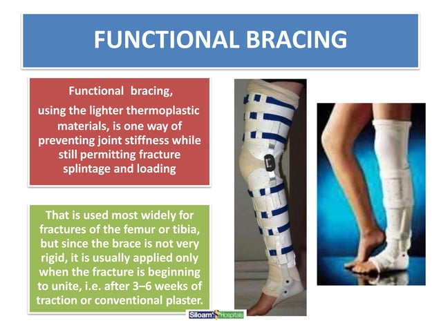 PPT trauma muskuloskeletal dr. Satria, Sp.OT.pptx
