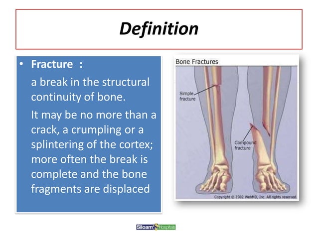 PPT trauma muskuloskeletal dr. Satria, Sp.OT.pptx