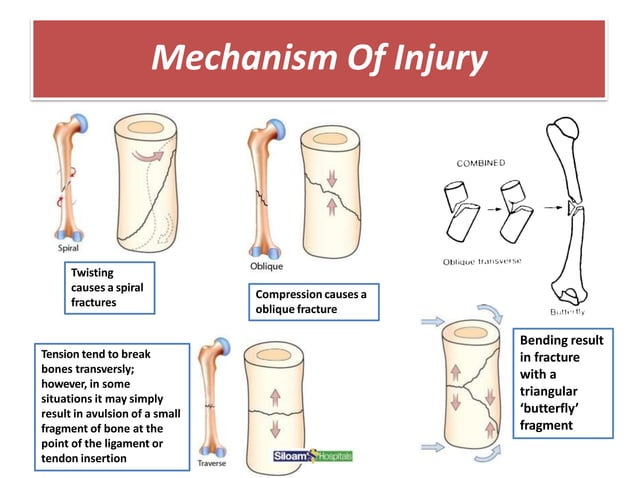 PPT trauma muskuloskeletal dr. Satria, Sp.OT.pptx