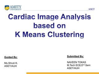 Cardiac Image Analysis based on K Means Clustering | PPT