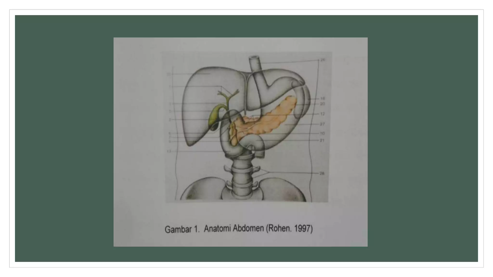 Ppt ct scan abdomen pada kasus tumor hati | PPTX