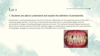 PPT TUTORIAL 3 SK 2 BLOK 9.pptx | Dental Health | Diseases and Conditions