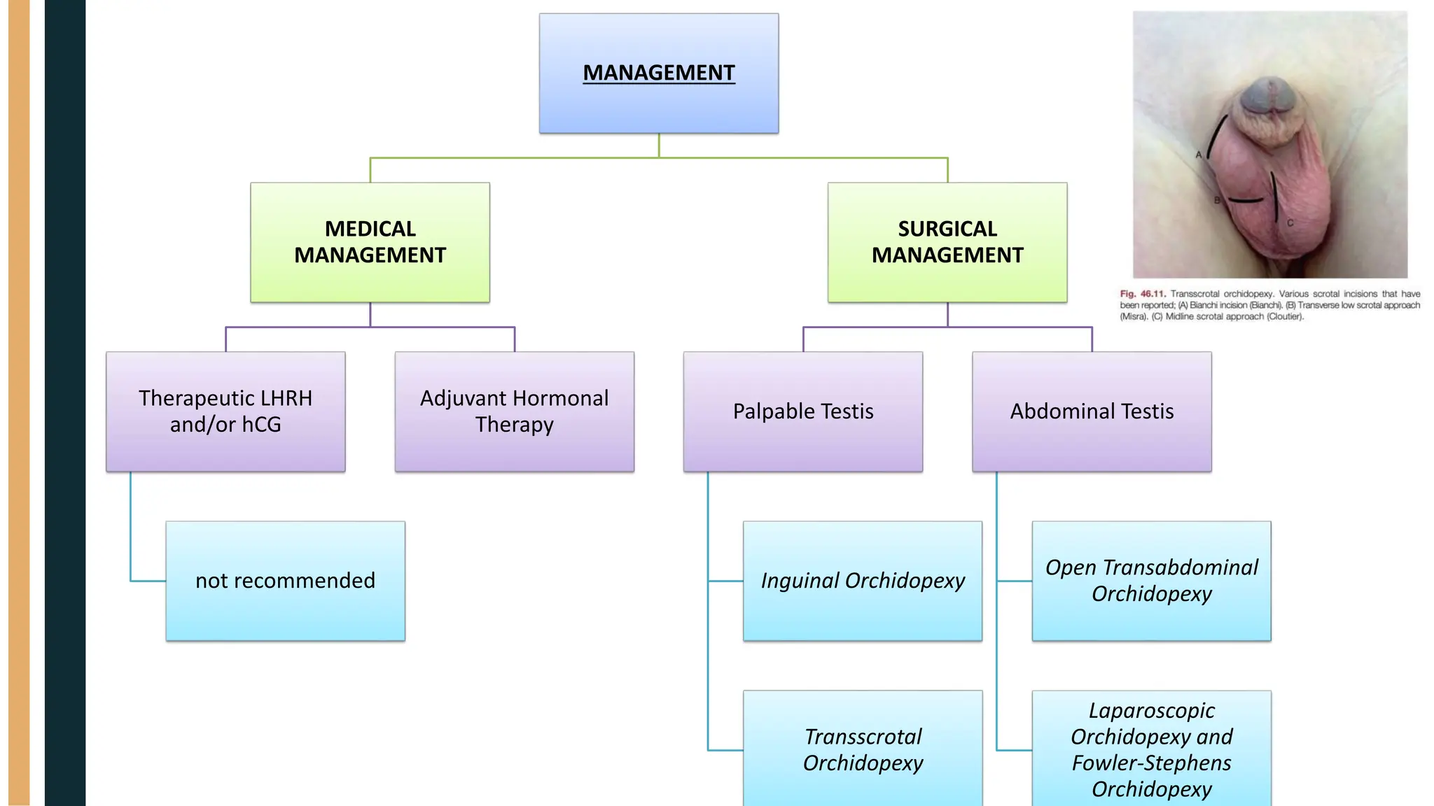 PPT Undesensus Testis Kriptokidismus UDT | PPT