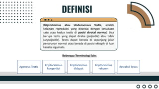 PPT Undesensus Testis Kriptokidismus UDT | PPT
