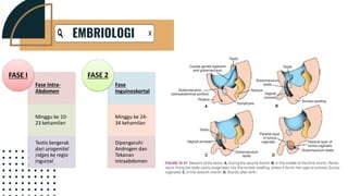 PPT Undesensus Testis Kriptokidismus UDT | PPT