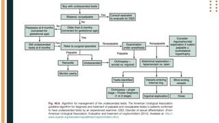 PPT Undesensus Testis Kriptokidismus UDT | PPT