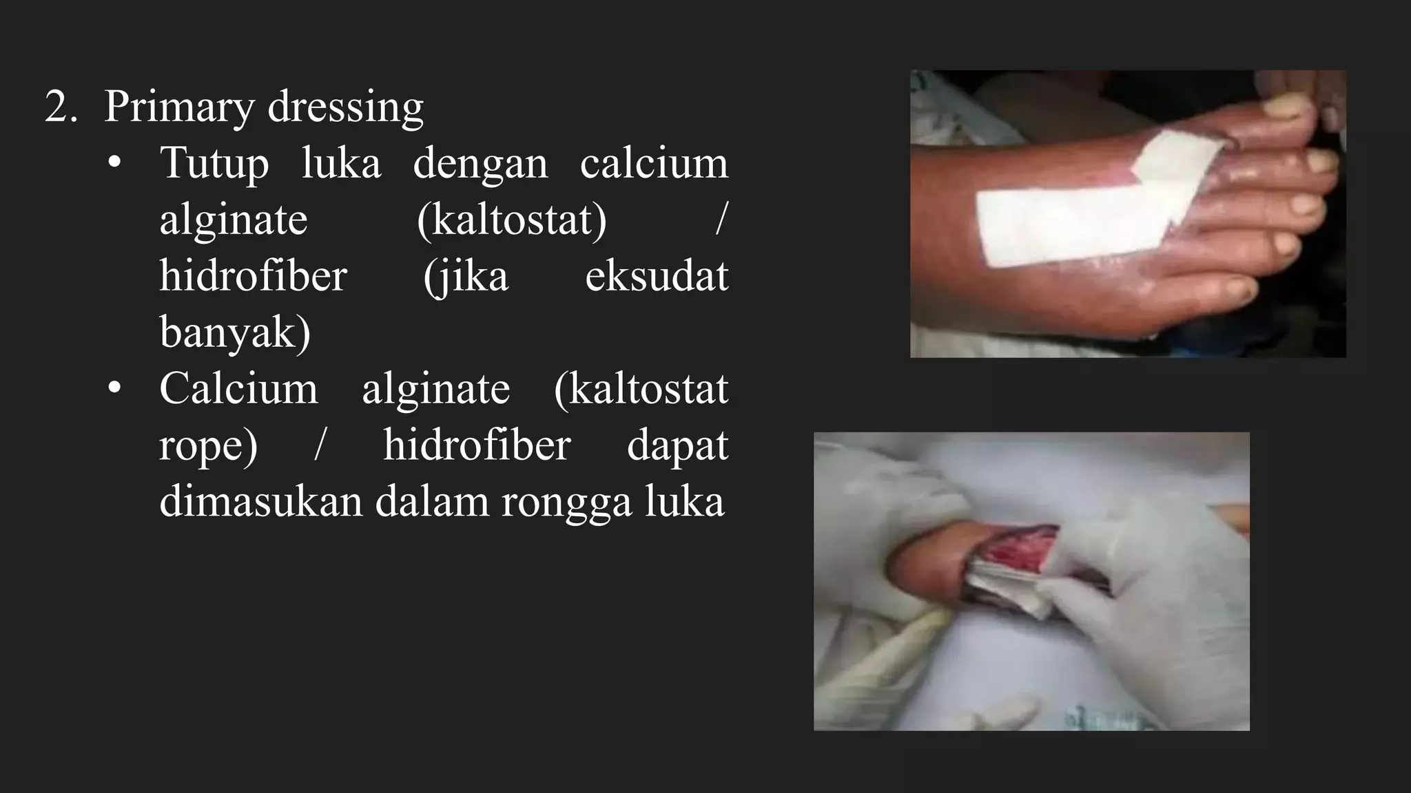 PPT ULKUS DIABETIKUM FENY.pptx