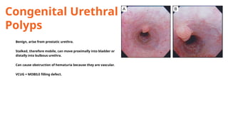 ppt urethra scrotum radiological findings.pptx