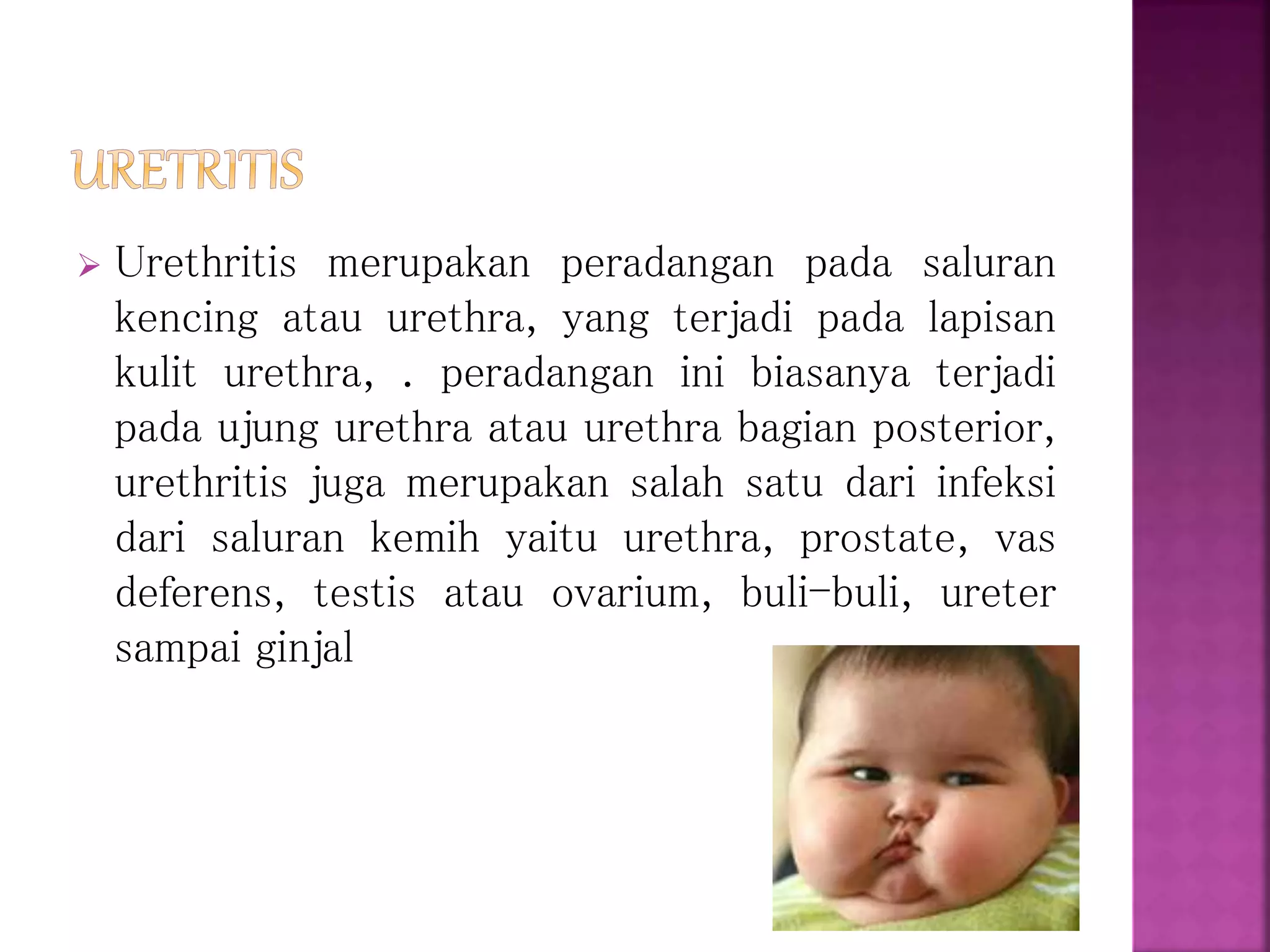 uretritis | PPTX