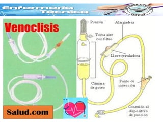 PPT VENOCLISIS (1).pdf
