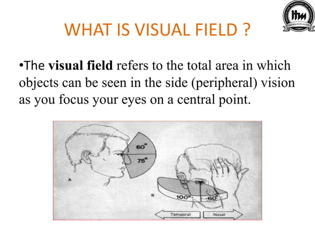 visual field assessment in low vision | PPTX | Eye and Vision ...
