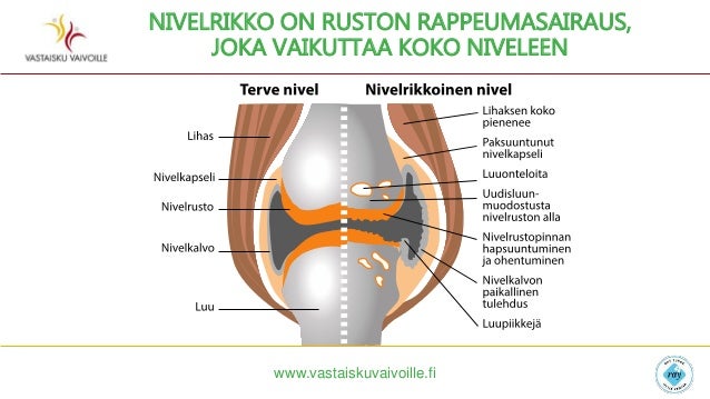 Ppt vv 170215_esitys