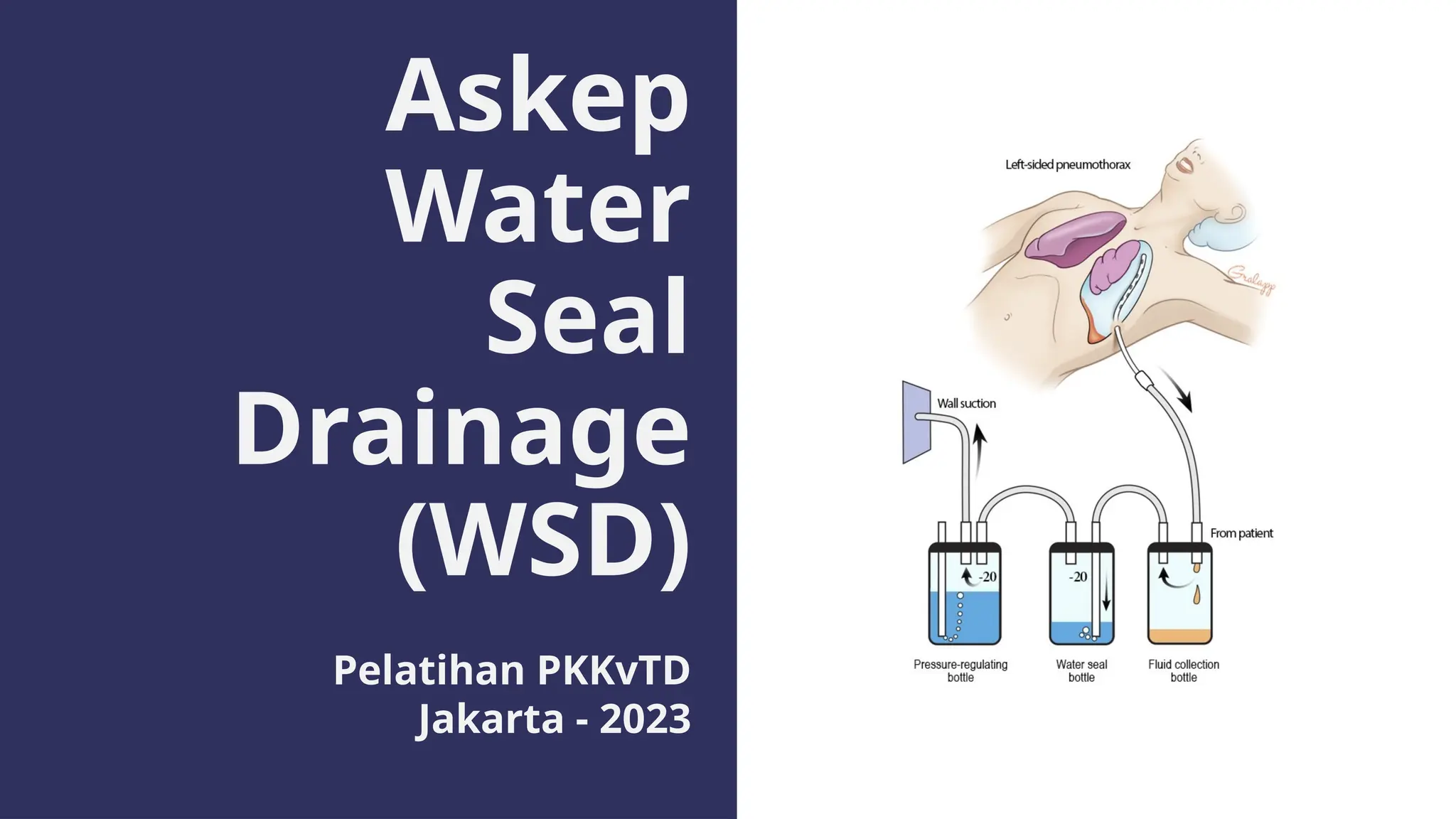 Materi Water seal drainage WSD 0001.pptx