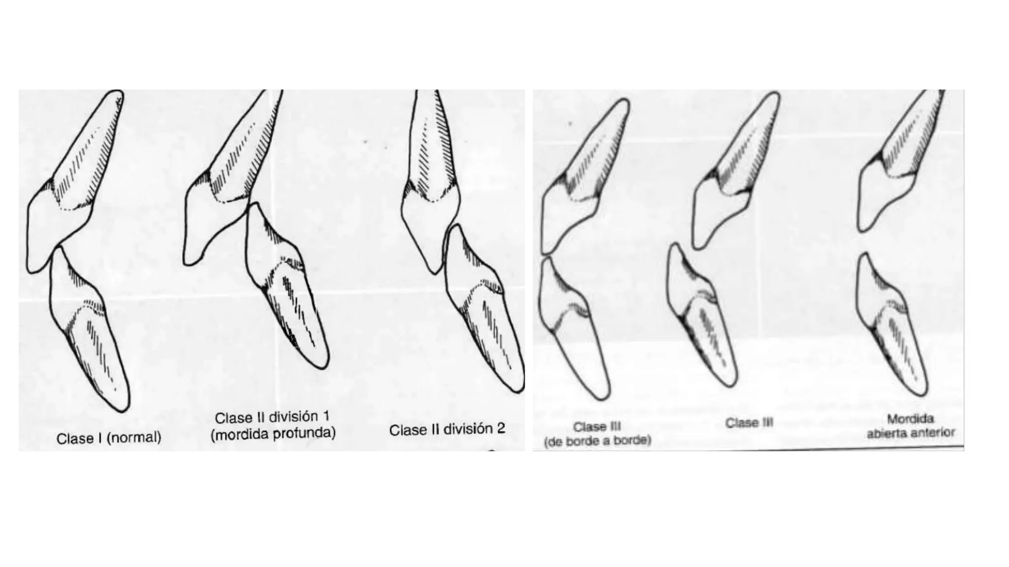 Morfología oclusal, materia de oclusión 1 | PPTX