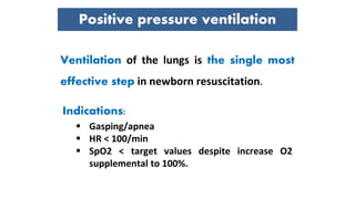 positive pressure ventilation in NRP | PPTX