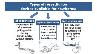 positive pressure ventilation in NRP | PPTX