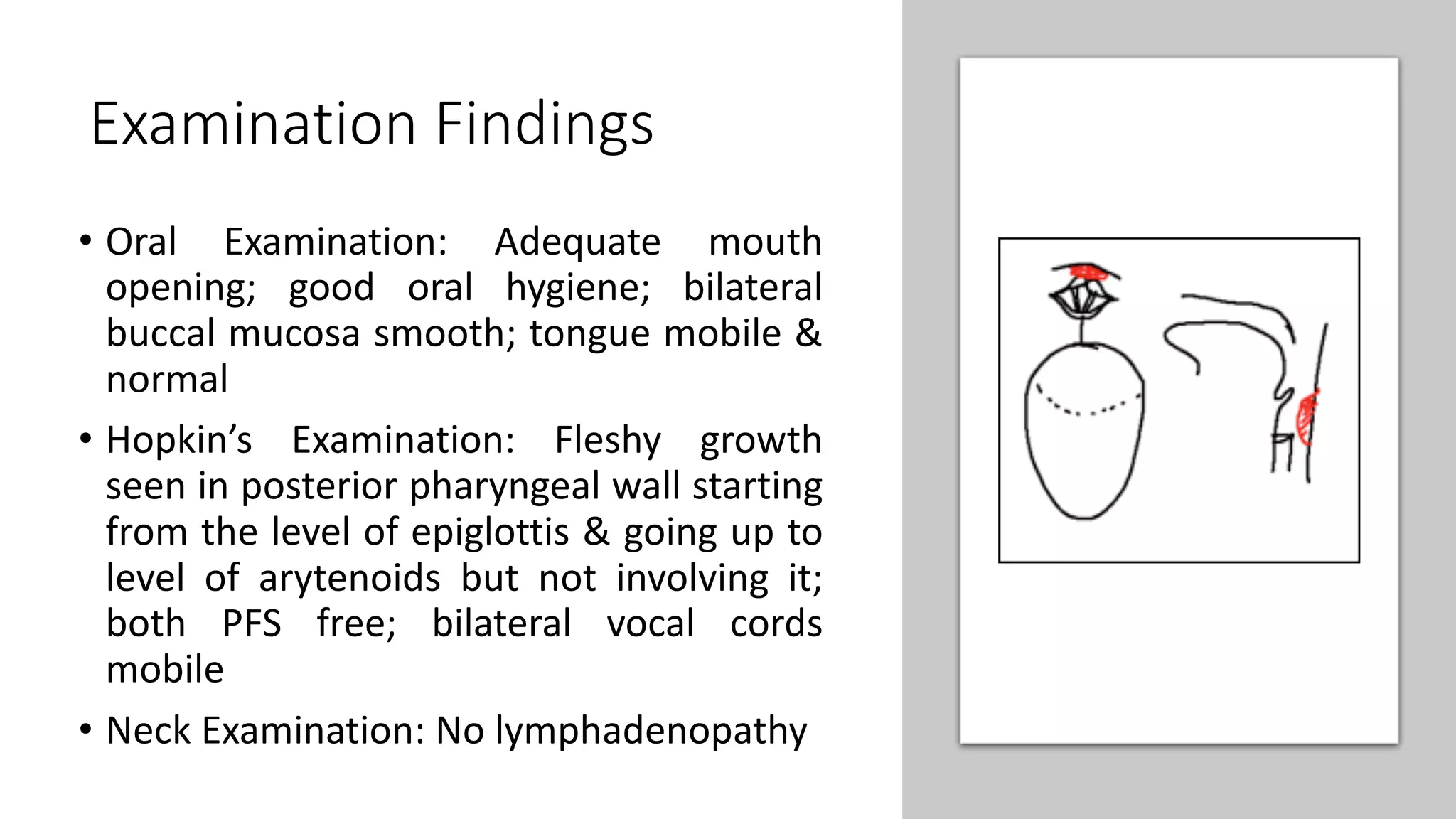 Posterior Pharyngeal Wall Brachytherapy | PDF