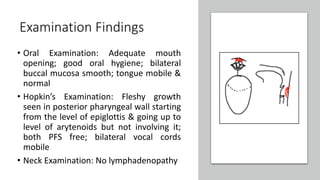 Posterior Pharyngeal Wall Brachytherapy | PPT