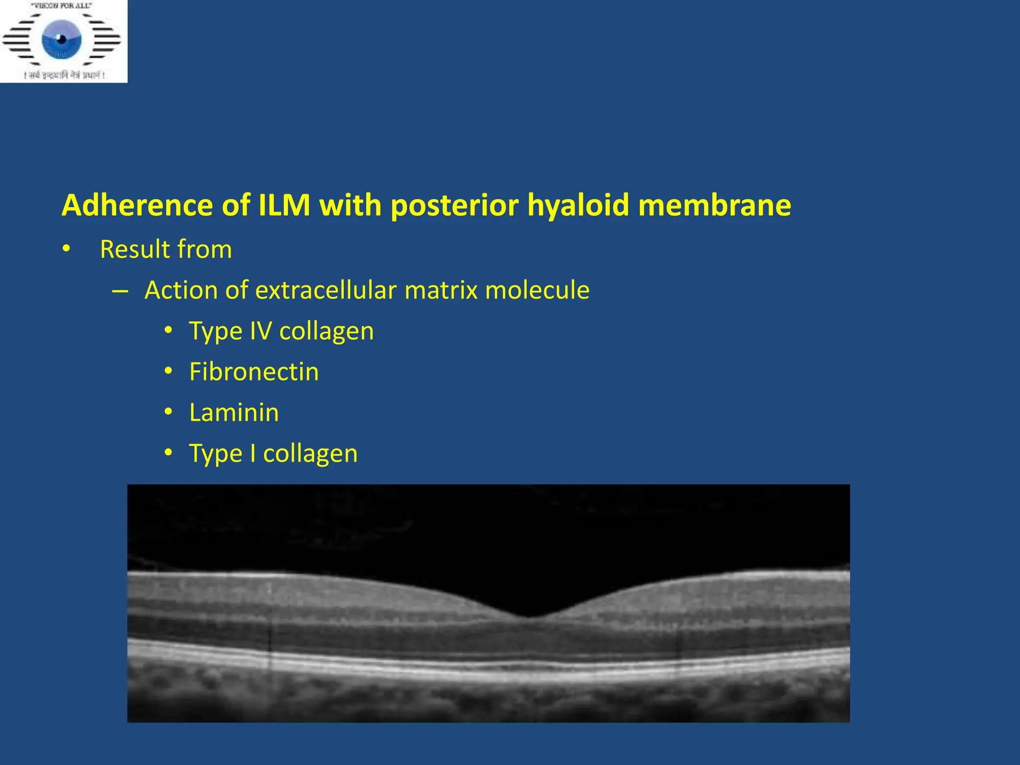 vitreous_anatomy__AND_SUBSTITUTE presentation dhir hospital bhiwani.pptx