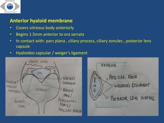 vitreous_anatomy__AND_SUBSTITUTE presentation dhir hospital bhiwani.pptx