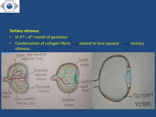 vitreous_anatomy__AND_SUBSTITUTE presentation dhir hospital bhiwani.pptx