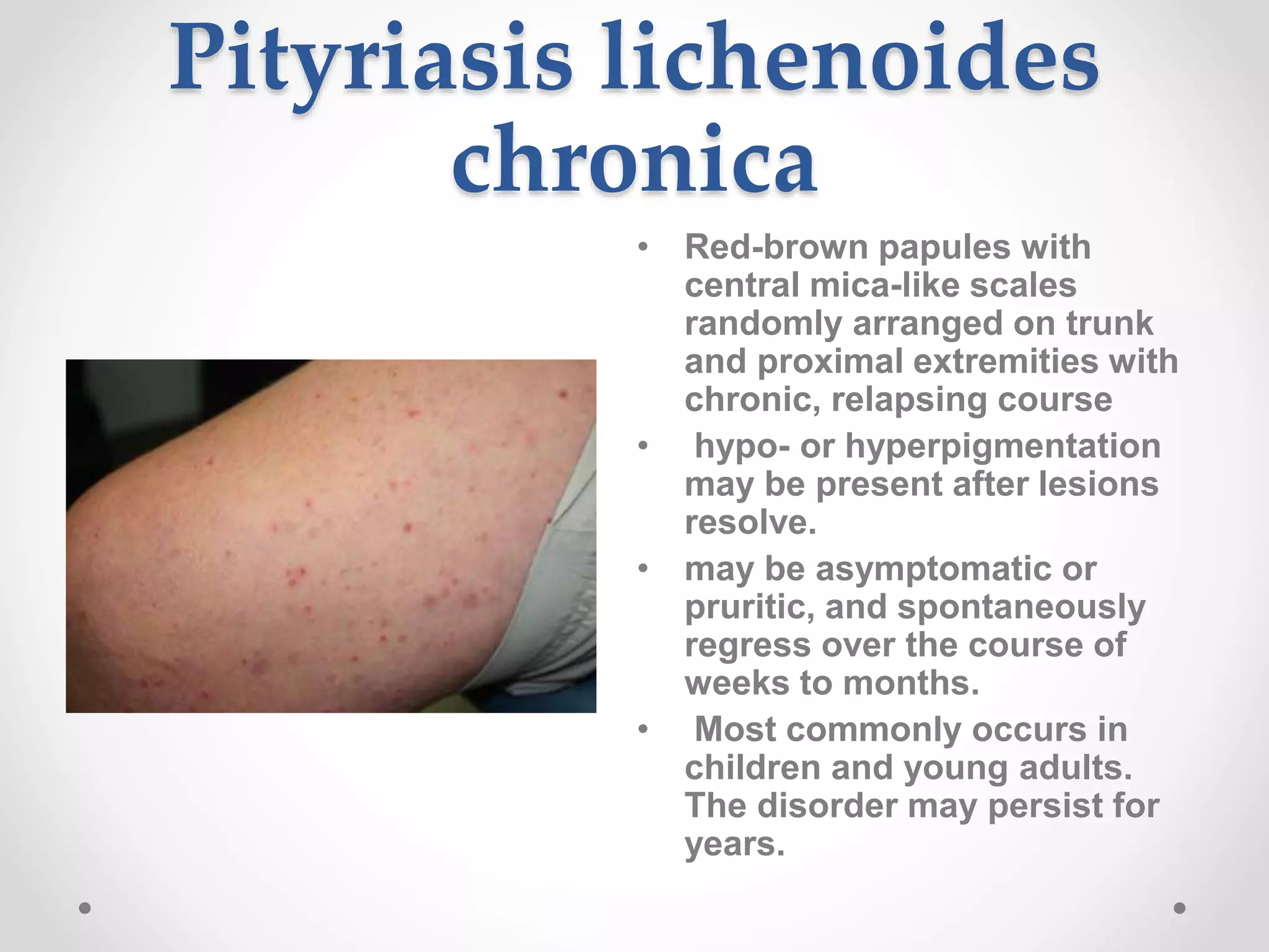Pityriasis rosea | PPTX