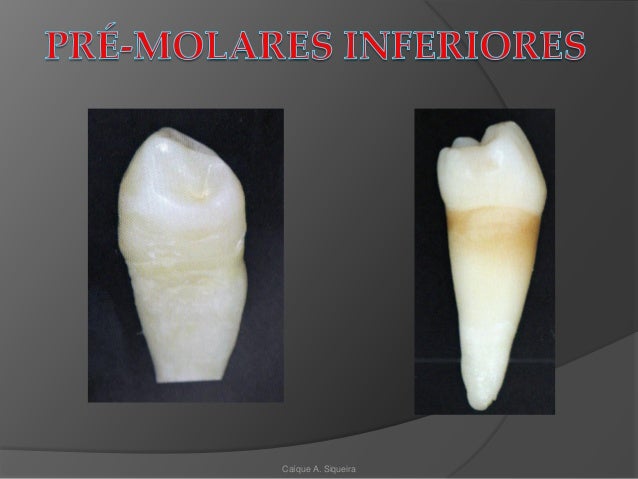 Aula Pré Molares Inferiores - Modo Simples