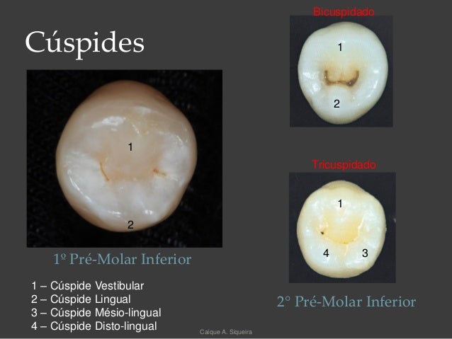 Aula Pré Molares Inferiores - Modo Simples