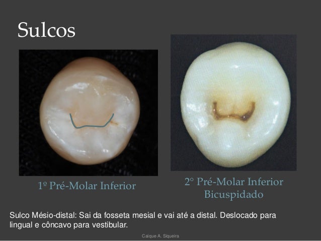 Aula Pré Molares Inferiores - Modo Simples