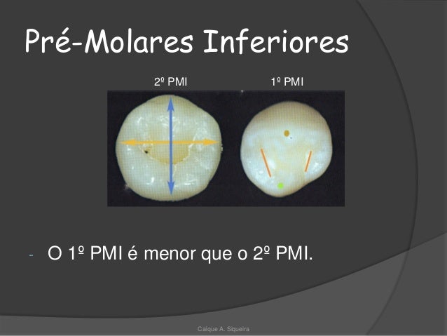 Aula Pré Molares Inferiores - Modo Simples