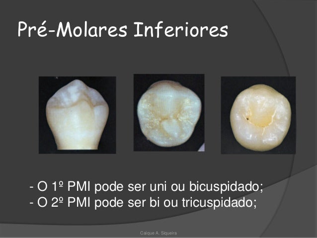 Aula Pré Molares Inferiores - Modo Simples