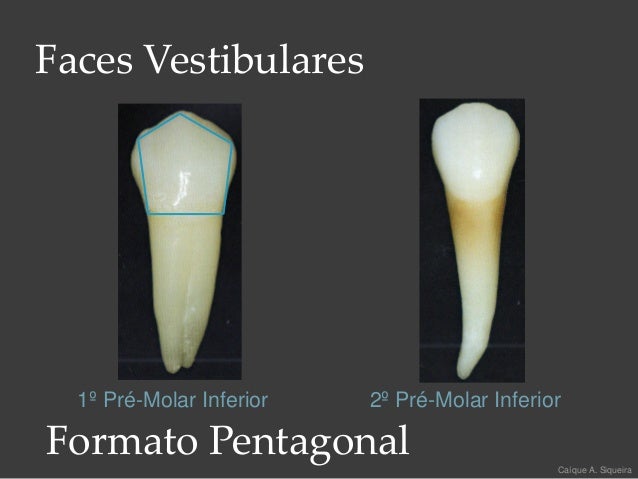 Aula Pré Molares Inferiores - Modo Simples