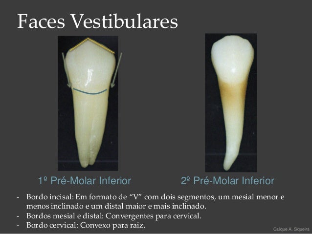 Aula Pré Molares Inferiores - Modo Simples