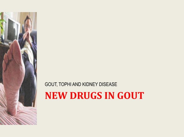 Gout, tophi and kidney disease | PPT